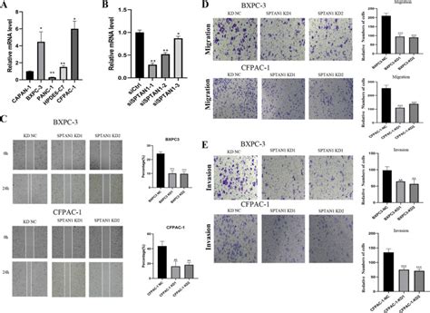 The Up Regulation Of Sptan1 Expression In Pancreatic Adenocarcinoma Is