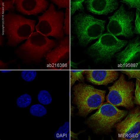 alexa fluor® 594 anti annexin 2 anxa2 antibody [epr13052 b ] ab216386
