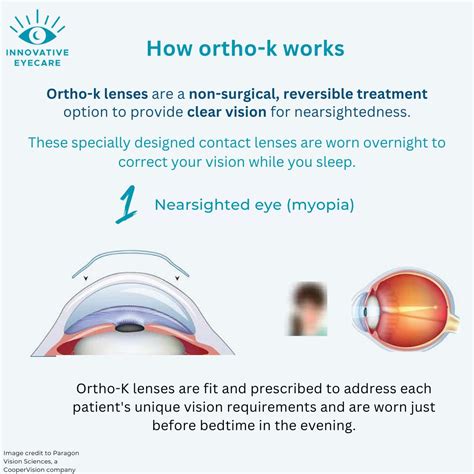Igreen Custom Glasses Want Unique Glasses That No One Has Cant Find The Color Or Style You