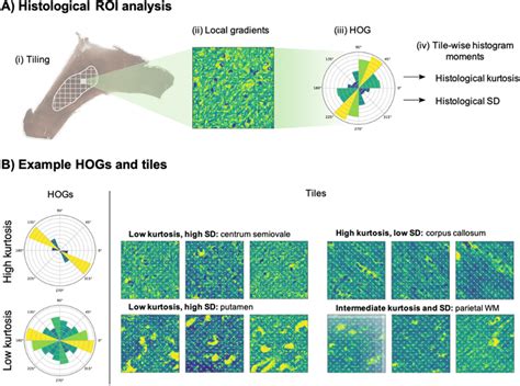 Quantitative Histological Analysis Method A Schematic Of The Download Scientific Diagram
