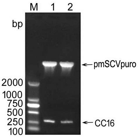 Recombinant Human Cc16 Gene Construction Of Eukaryotic Expression Vector Of Cc16 Gene And