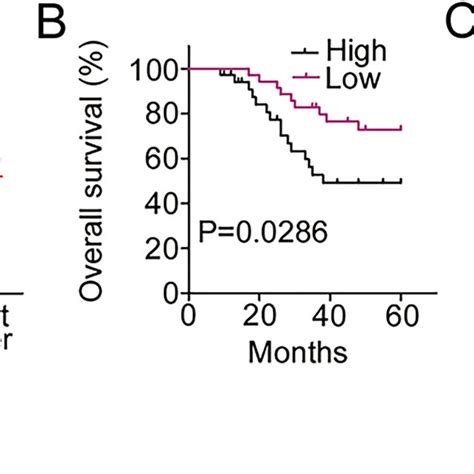 Long Intergenic Nonprotein Coding Rna 02163 Linc02163 Is Upregulated