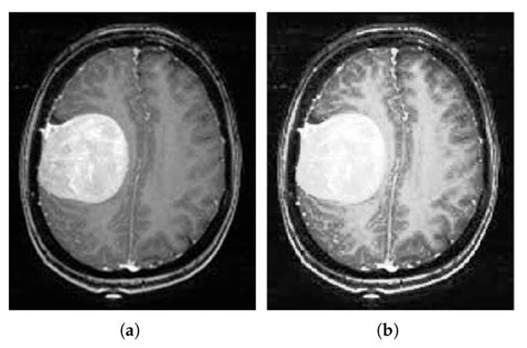 Linear Contrast Stretch Outcomes A Input Brain Mri B Final Download Scientific Diagram