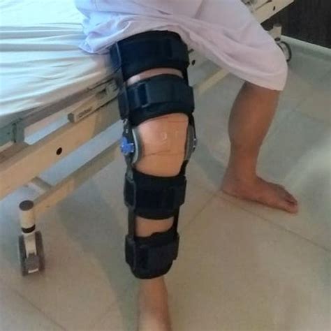 Jual Knee Brace Post Op Acl Kota Tangerang Op Varado Tokopedia
