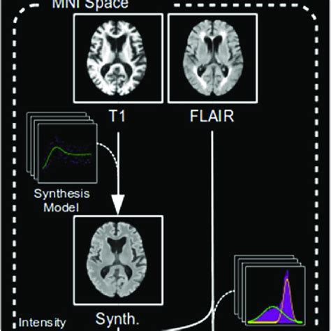 An Overview Of The Process Of Creating The L Syn And L Flair Likelihood Download Scientific