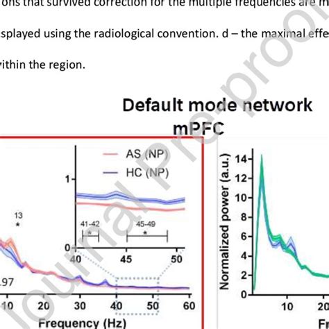 Increased Alpha Power In The Ascending Nociceptive Pathway Is