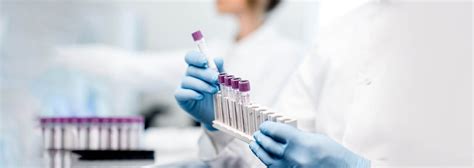 Biotech Quest Diagnostics