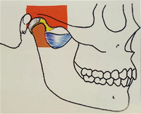 Introduction To Occlusion Pocket Dentistry