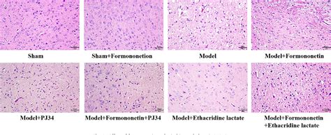 Figure 1 From Formononetin Alleviates Cerebral Ischemia Reperfusion