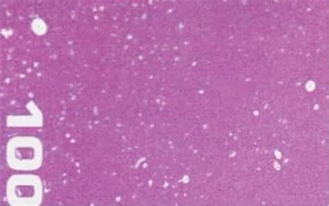 Troubleshooting Flexographic Printing Defects A Guide To Better Print