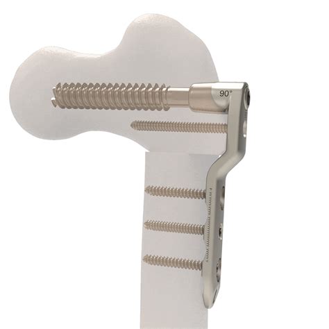 Deformity Correction Orthopediatrics