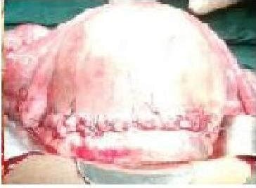 Intraoperative View Download Scientific Diagram