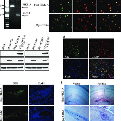 Pike A Interacts With Cdk4 In Vitro And In Vivo A Gst Pull Down