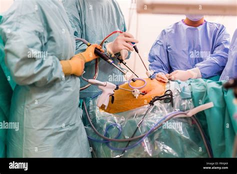 Endometriosis Laparoscopy