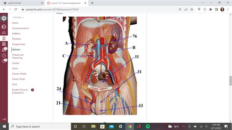 Lab 23 Diagram Quizlet
