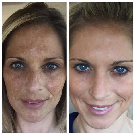 Christina Pearson Redefining Beautiful Real Peopleamazing Results