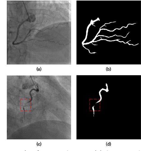 Figure 1 From Reconstruction Of Partially Broken Vascular Structures In