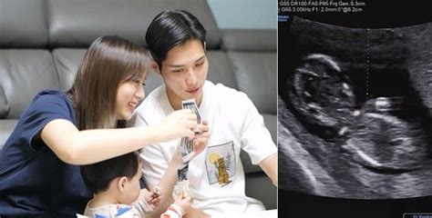 방송 ‘슈돌 펜싱스타 김준호 둘째 임신 경사 “태명은 은동이” Ytn