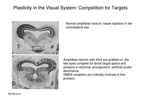 PPT The Visual Cortex Anatomy PowerPoint Presentation Free Download ID 6628156