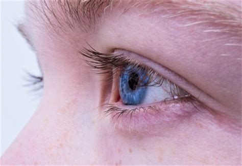 Hemianopsia Qué Es Tipos Causas Síntomas Tratamiento Diagnóstico