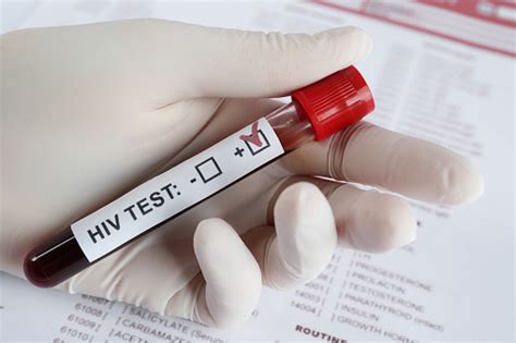 혈액 샘플이 있는 튜브를 들고 실험실 형태 근처에서 Hiv 테스트에 라벨을 붙이는 과학자 근접 촬영 Stem 주제에 대한 스톡