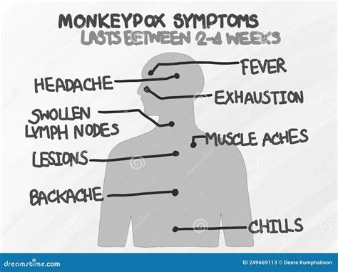 Monkey Pox Smallpox Pox Virus Stock Illustration Illustration Of