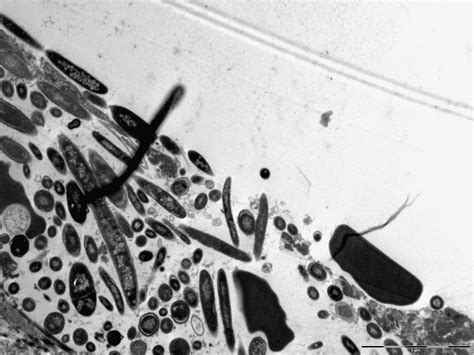 Questions With Answers In Fungal Infection Science Topic
