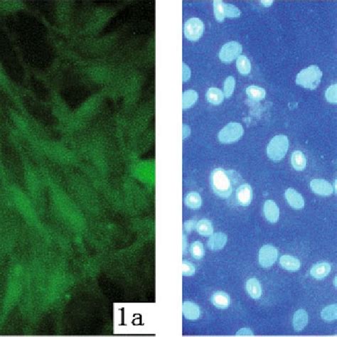 Immunocytochemical Staining Of Bone Marrow Stromal Cells 1a Cd44