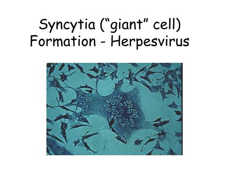 Ppt Human Viral Disease Virus Replication Cycle Powerpoint
