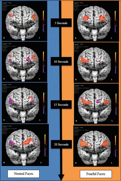 Activation Patterns Observed At 5 S Intervals Following Neutral And Download Scientific Diagram