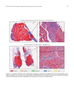 Cellvit Vision Transformers For Precise Cell Segmentation And