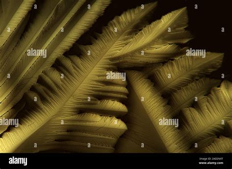 Citric Acid Crystals Polarized Light Micrograph Of A Section Through