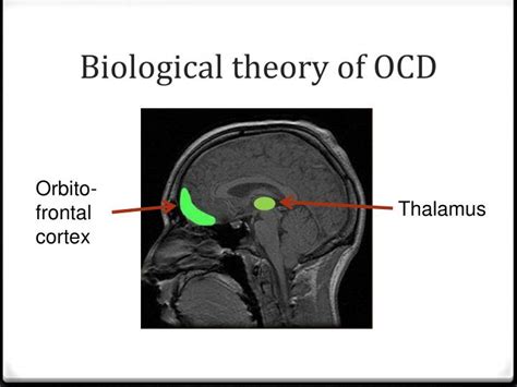 PPT Biological Explanations And Treatments Of OCD PowerPoint