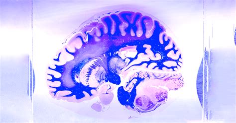 History Science And Ethics At The Cushing Center Brain Collection