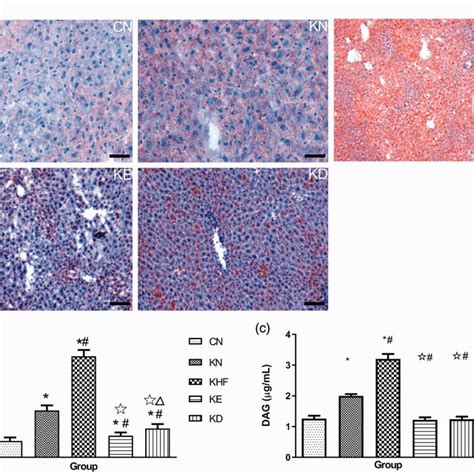 Exercise And Dpp 4 Inhibition Decreased Hepatic Lipid Accumulation In