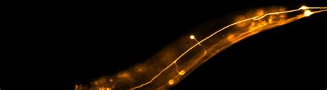 The Tiny Roundworm A Key Player In Brain Science Uq Queensland Brain