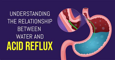 Water Brash The Relationship Between Water And Acid Reflux