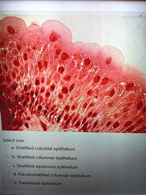 Solved Select One Stratified Cuboidal Epithelium B Stratified