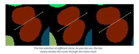 Github Prubiocosta3d Cell Segmentation With Imagej