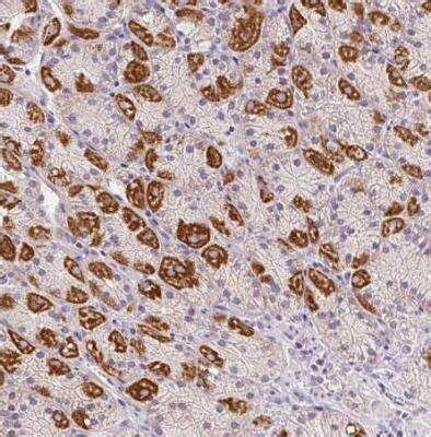 Noxa Antibody NBP2 48996 Novus Biologicals