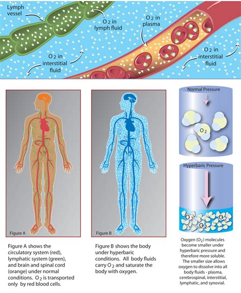 Hyperbaric Oxygen Therapy Valley Health And Hyperbarics Hbot Therapy