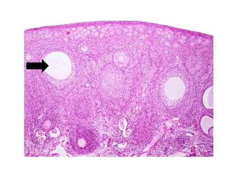 Female Reproductive Lab Histology Flashcards Quizlet