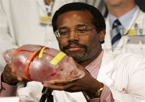 Ben Carsons Twin Separation Surgery Face2face Africa