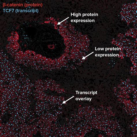Spatial Transcriptomics Standard Biotools