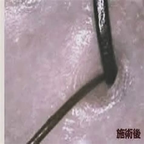 【薄毛ケアで頭皮を健康に！美容室が提案するケア方法とは？】 ブログ 長崎市の美容室なら理学美容院ひで