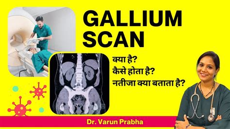 What Is A Gallium Scan Test At Trudi Abbas Blog