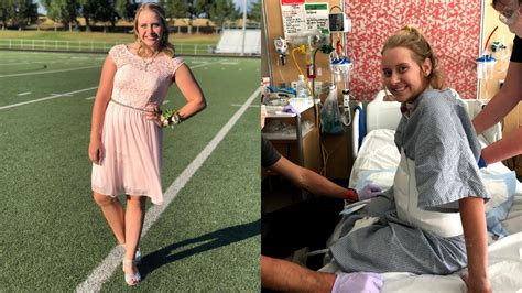 Inspiring Story Of Woman Who Lost Legs In Crash Completes Pull Up