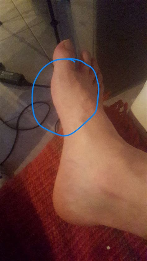 Injured Back Foot From Split Jerk Has This Happened To Anyone R Weightlifting