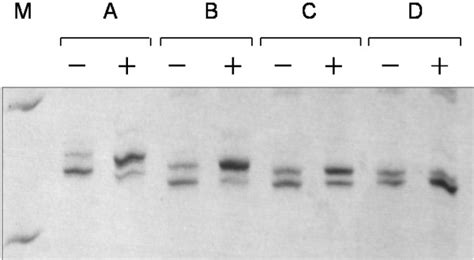 Representative Data Of X Chromosomal Inactivation Patterns In Subjects