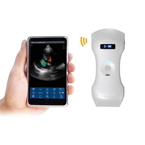 Suresult Wireless Linear Ultrasound With Convex Probe And 3 Buttons Color Doppler